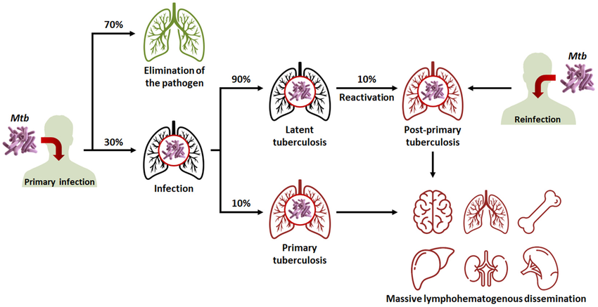 Mitigating TB Burden In India